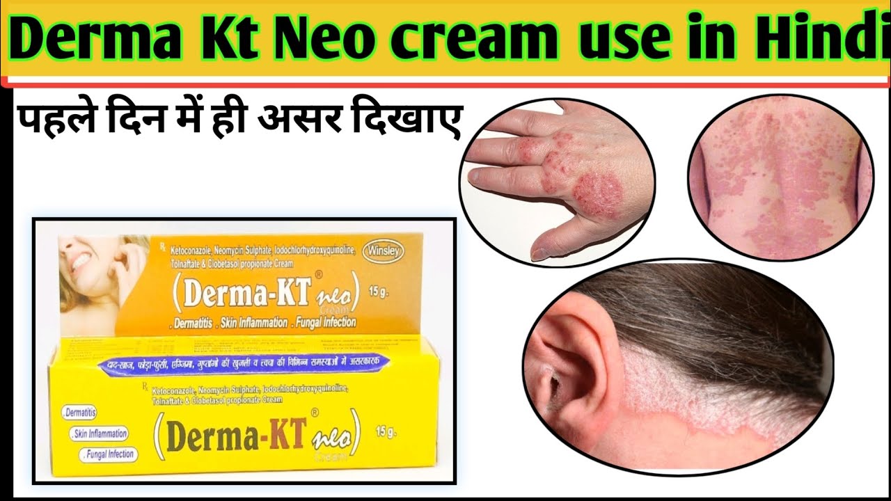 derma KT Neo cream use in Hindi allergy ke liye cream @DrAkeel603 # ...