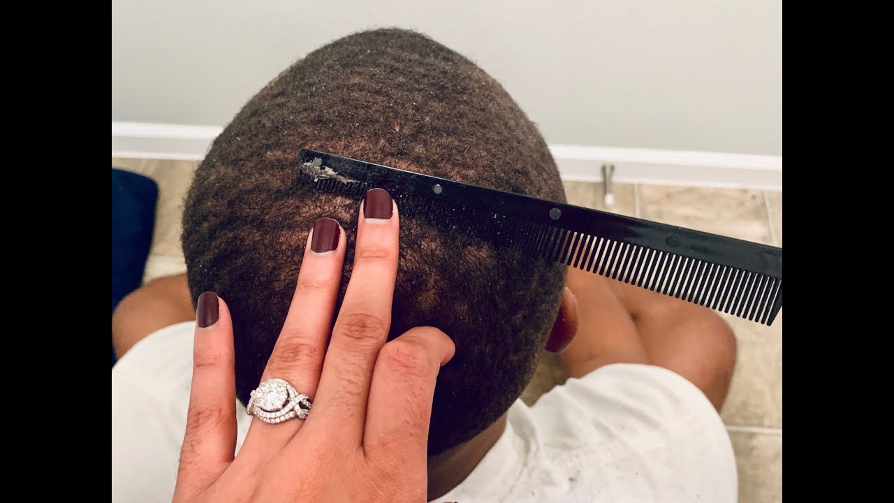 Dandruff Scratching Asmr Dandruff Flakes Youtube
