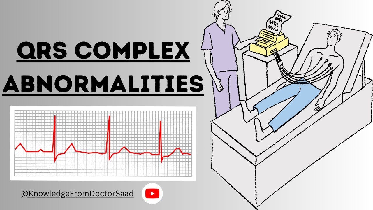 Understanding QRS Complex Abnormalities: Causes, Symptoms, and ...