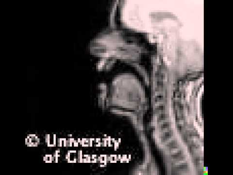 MRI voiced alveolar lateral-approximant - YouTube