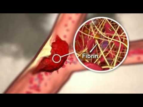 Alteplase - Mechanism of Action : Pharmamates - YouTube