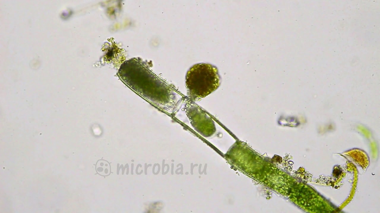 Vampyrellid amoeba/ Амеба-вампир под микроскопом - YouTube