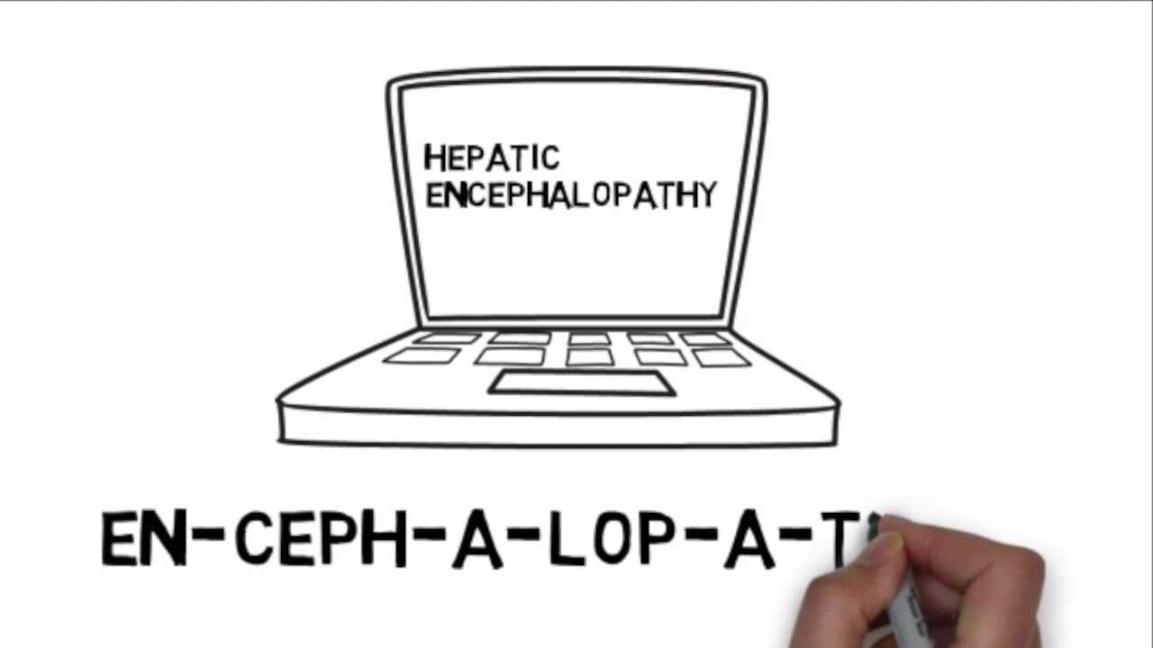 Hepatic Encephalopathy: Information for Patients with Liver Disease ...