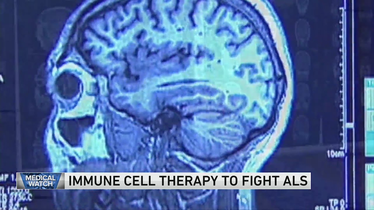 Immune cell therapy to fight ALS — and more - YouTube