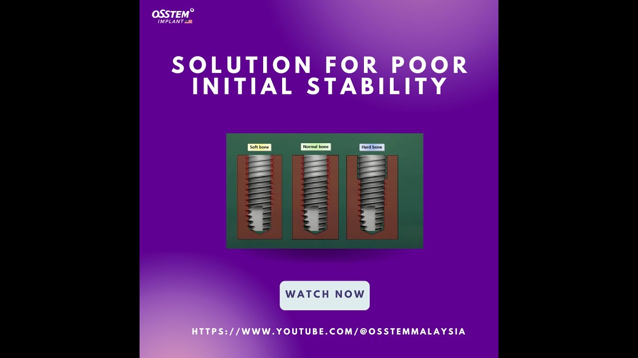 [Master Course - SURGERY] Solution for poor initial stability - YouTube