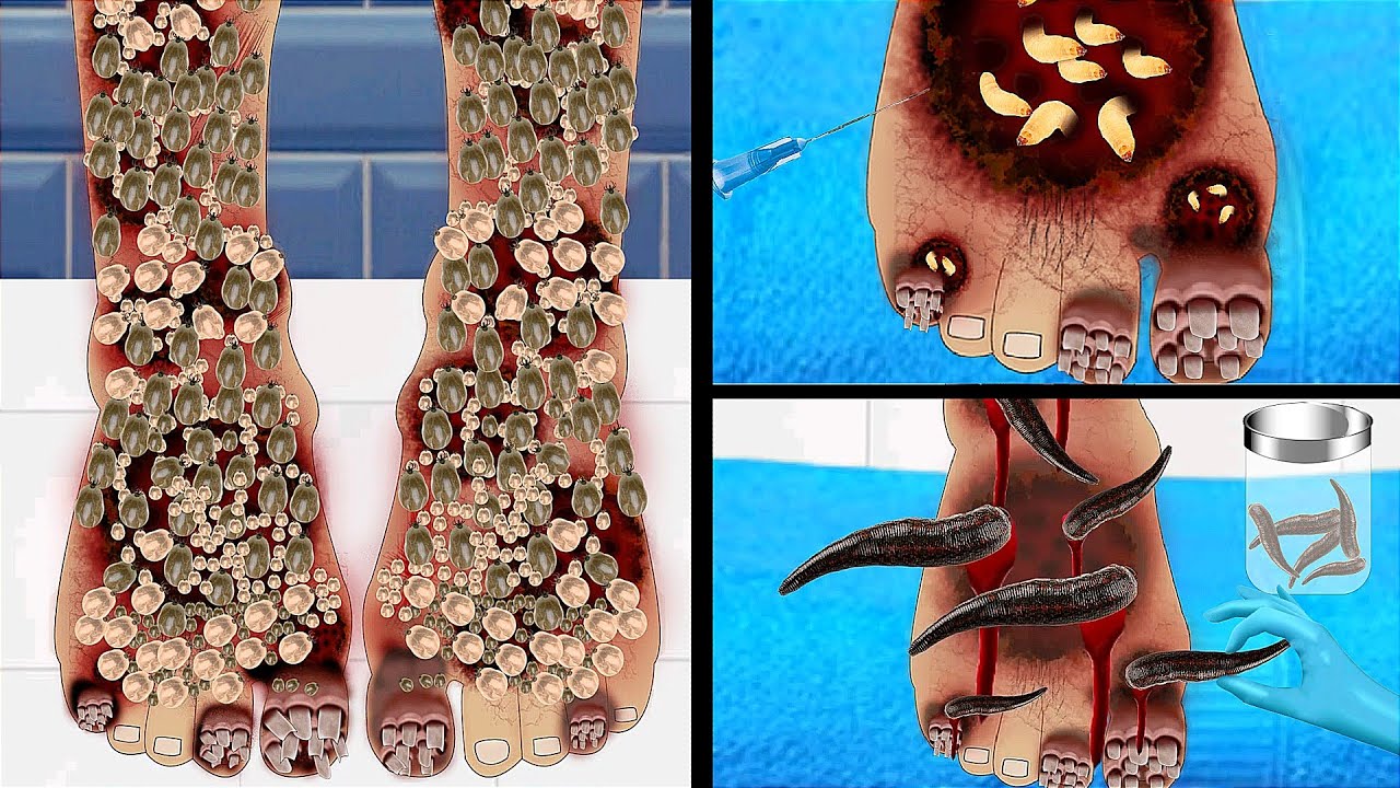 ASMR Treatment of injured legs | ASMR Care animation | 2d animation ...