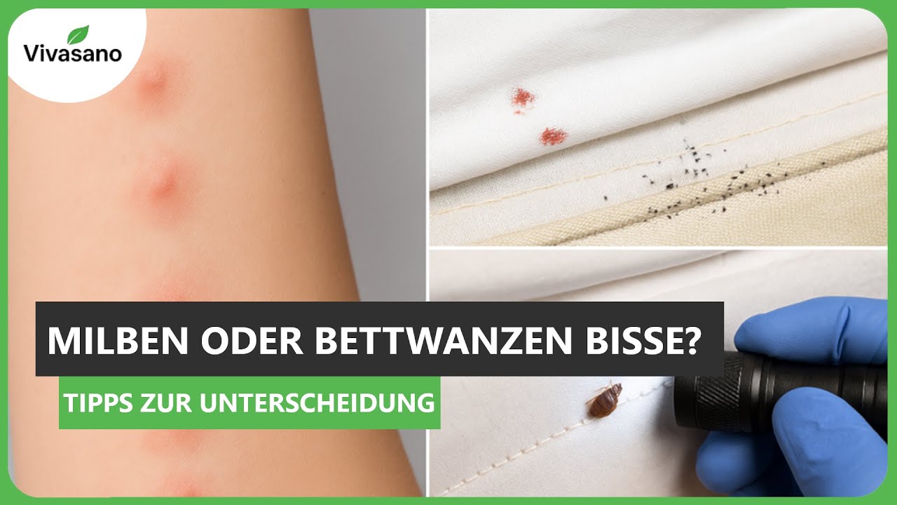 Insektenstiche Flohbisse Milben Bettwanzen Bisse