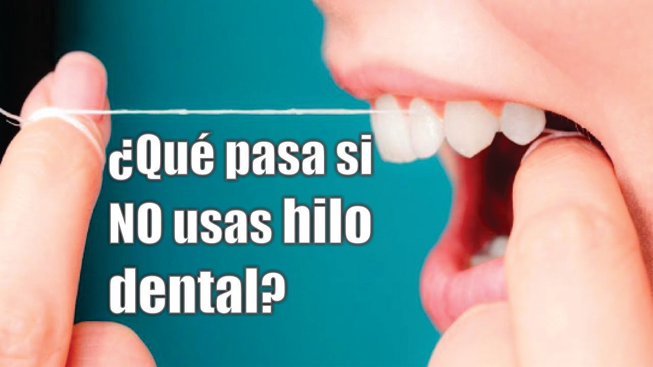 ¿DEBEMOS USAR HILO DENTAL? 🦷 CORRECTO USO del FLOSS PICK 😬 DR YURI ...