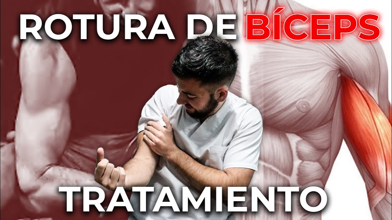 TRATAMIENTO de la ROTURA del tendón del bíceps 🤕 - Opinión de ...