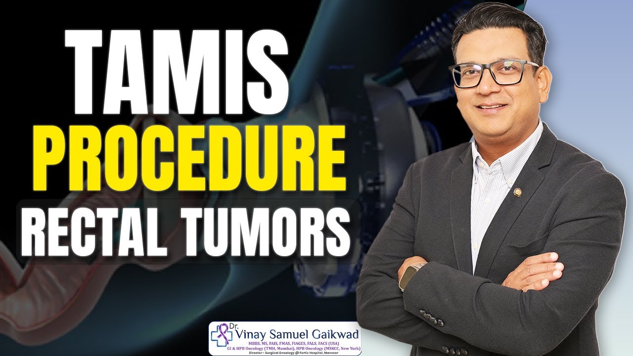 TAMIS Procedure: Invasive Approach for Rectal Tumors | Dr Vinay Samuel ...