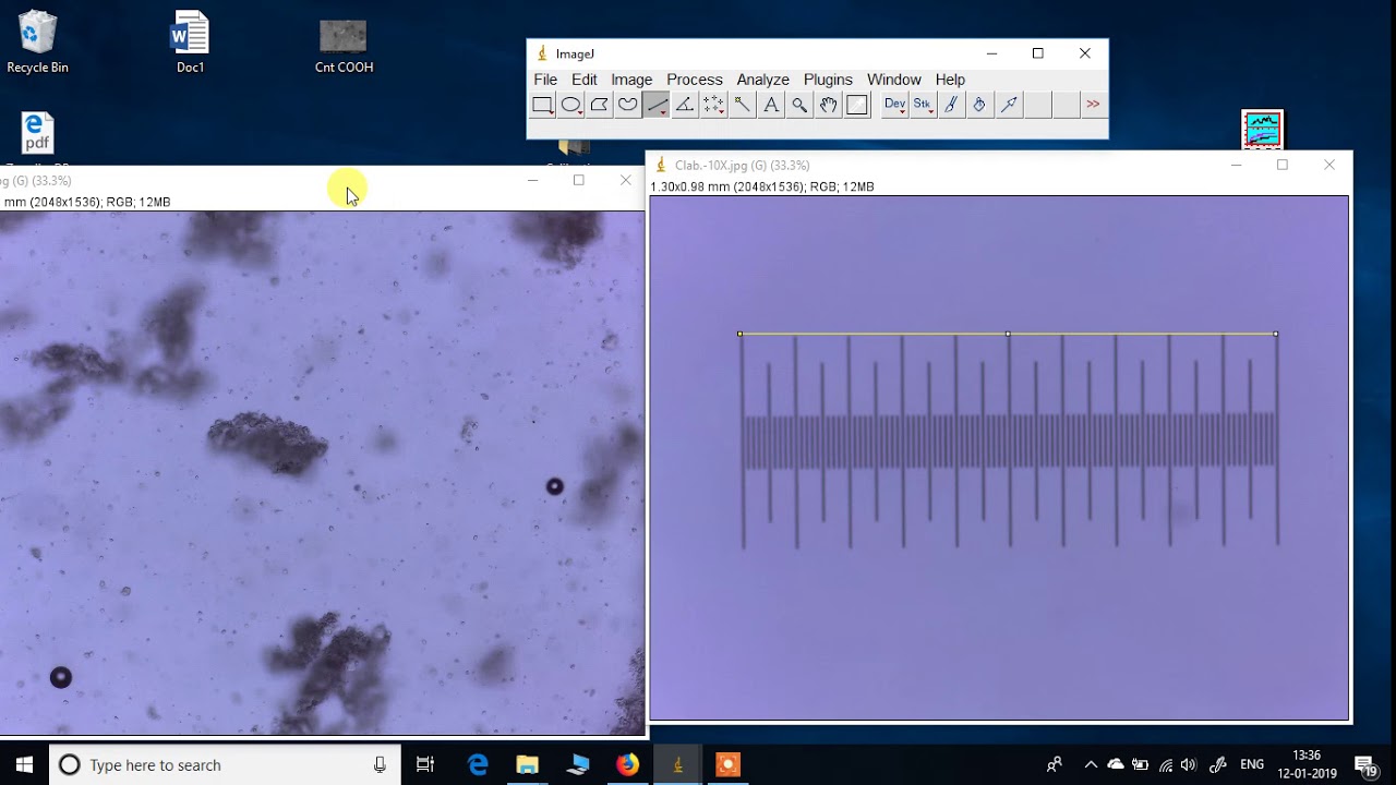 Scale Bar Placement In Microscopy Image YouTube Scale Bar Placement In Microscopy Image YouTube