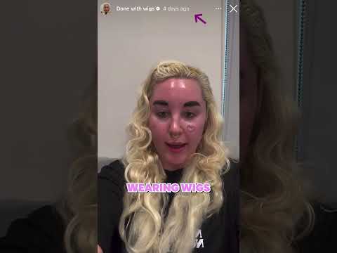 Amanda Bynes raises concerns - Part 1 #celebrity #trending #news #amandabynes #celebritynews