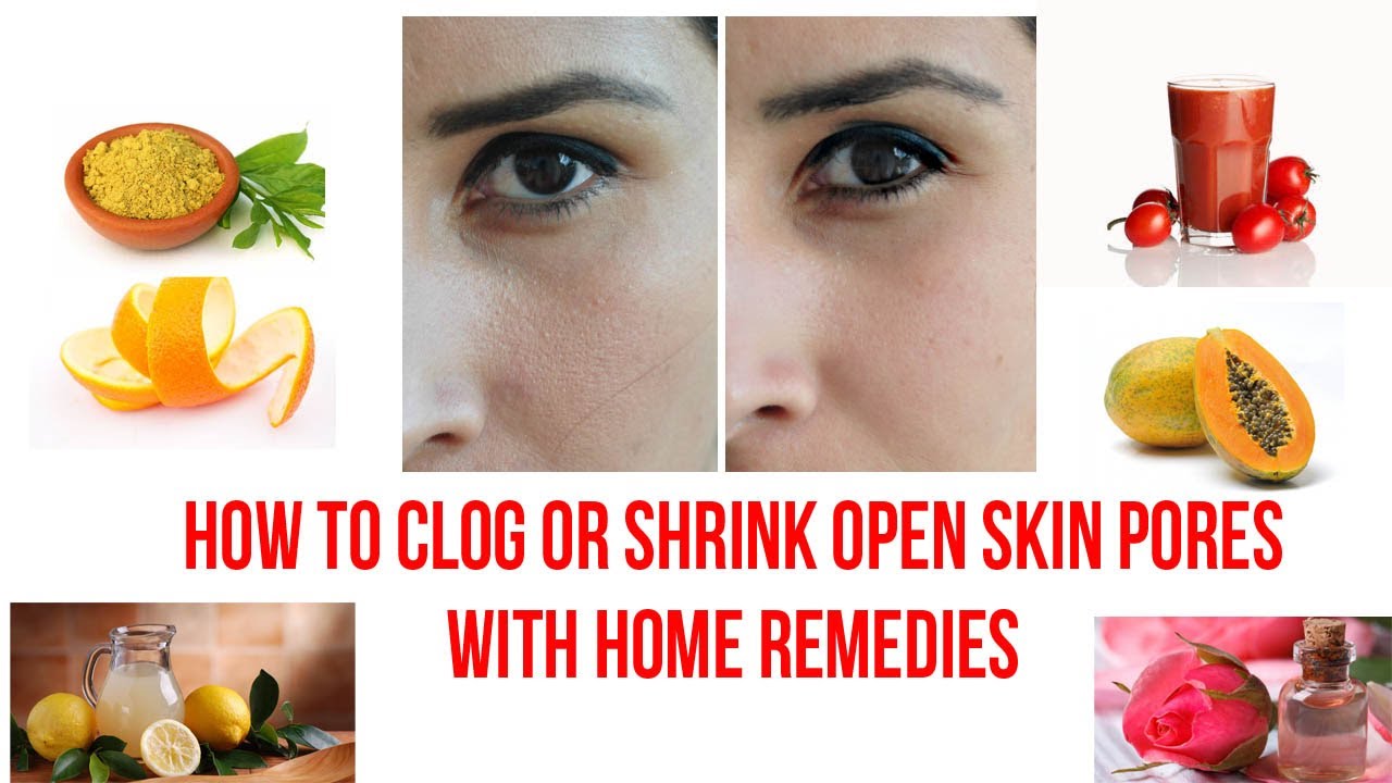 Get 100% Results! How To Treat Large Open Pores Naturally At Home ...