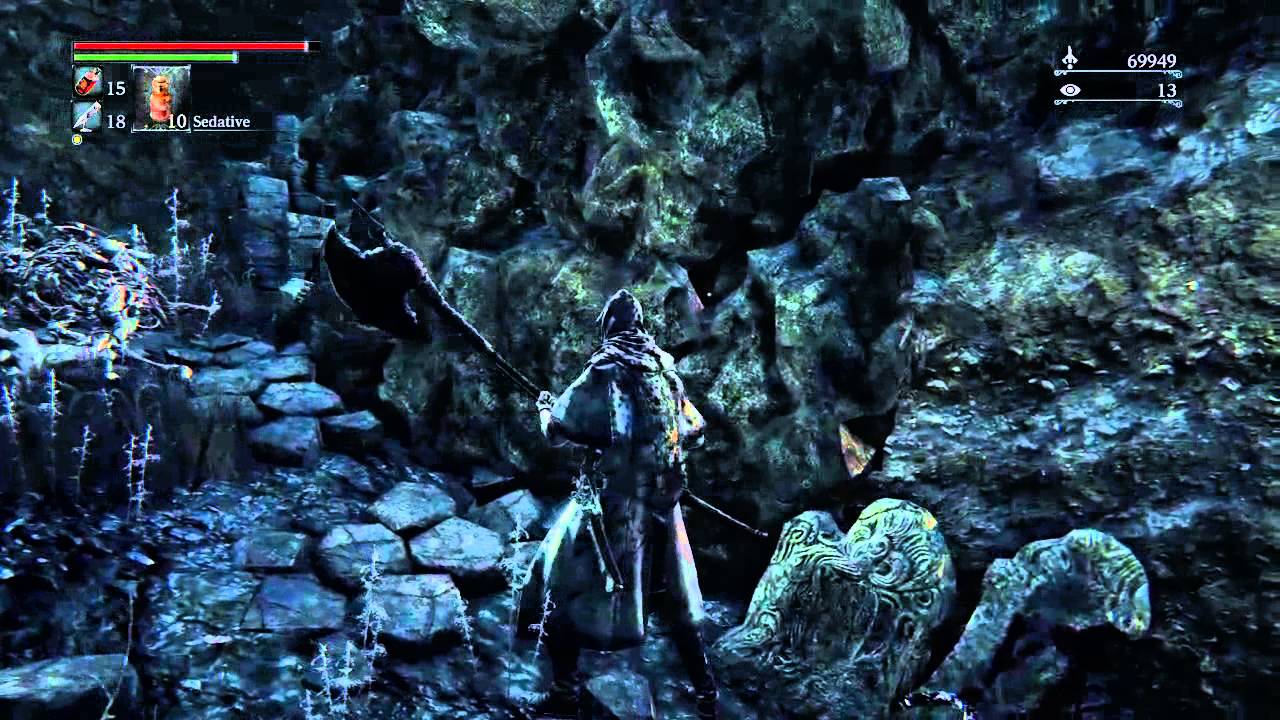 Bloodborne Walkthrough Strategy Pt. 31, Nightmare Frontier Pt. 2 - YouTube