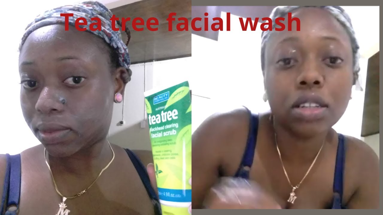 How I Get Rid Of White Heads black Head my Skin Care YouTube how-i-get-rid-of-white-heads-black-head-my-skin-care-youtube