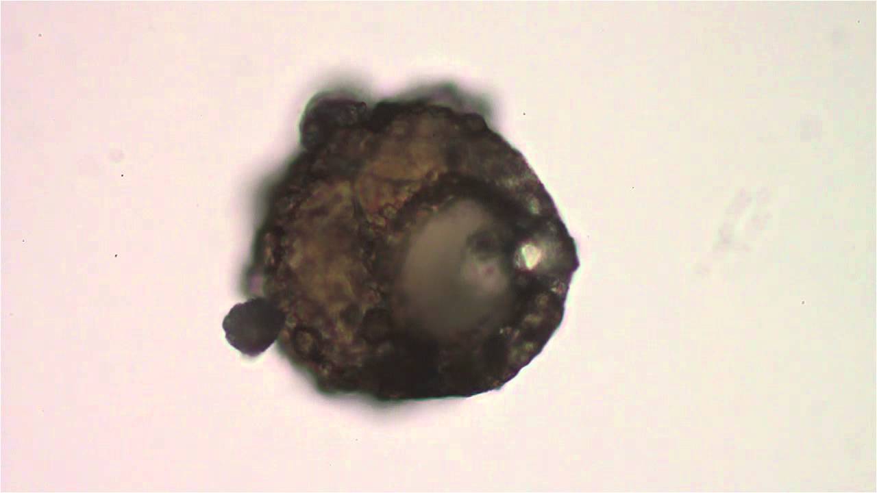 Vacant Difflugia Testate Amoeba Shells - YouTube
