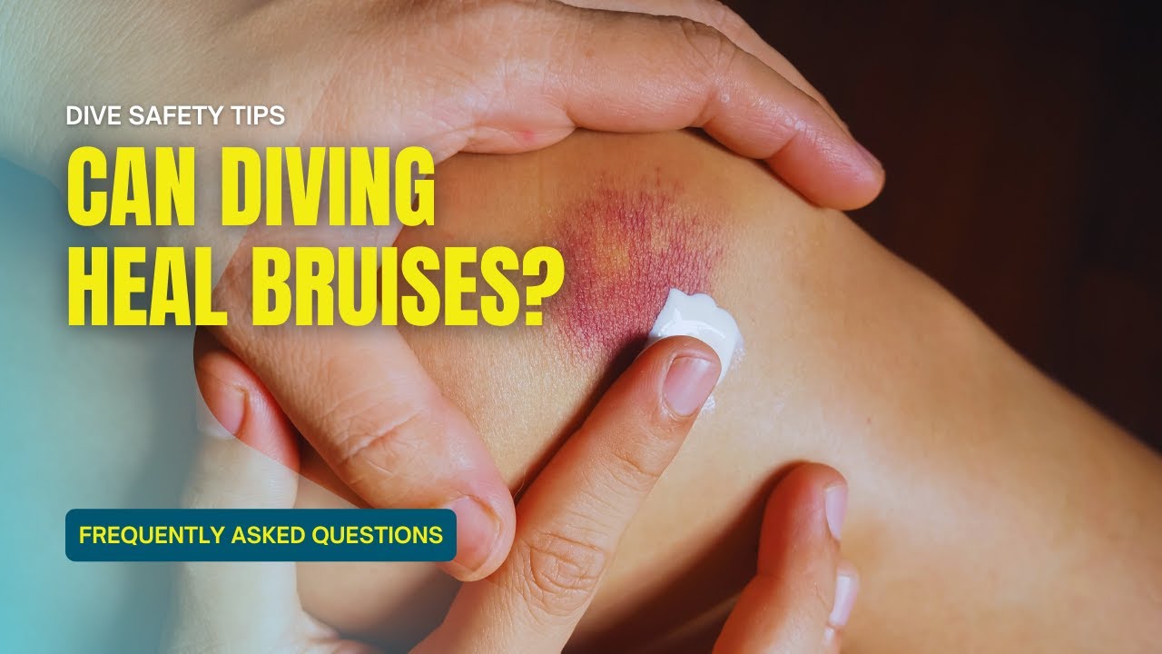 FAQ Can diving get rid of my bruises? - YouTube