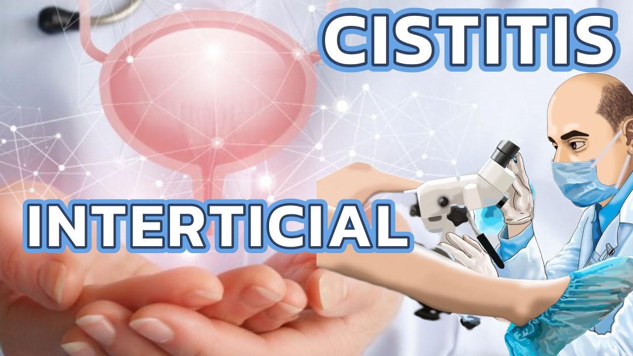 Cistitis Intersticial Causa de Urgencia Urinaria Resumen USMLE - YouTube