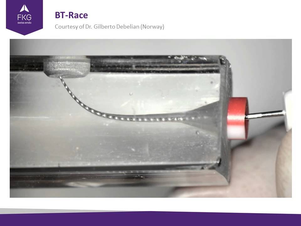 FKG BT Race und Total Fill - YouTube