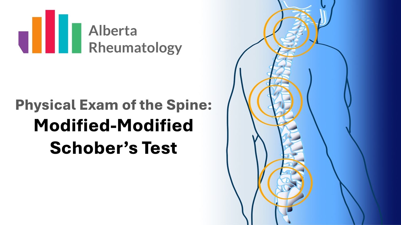 Rheumatology BACK exam: Schober's Test - YouTube