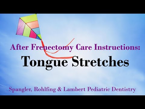 After Frenectomy Care Instructions- Tongue Stretches - YouTube