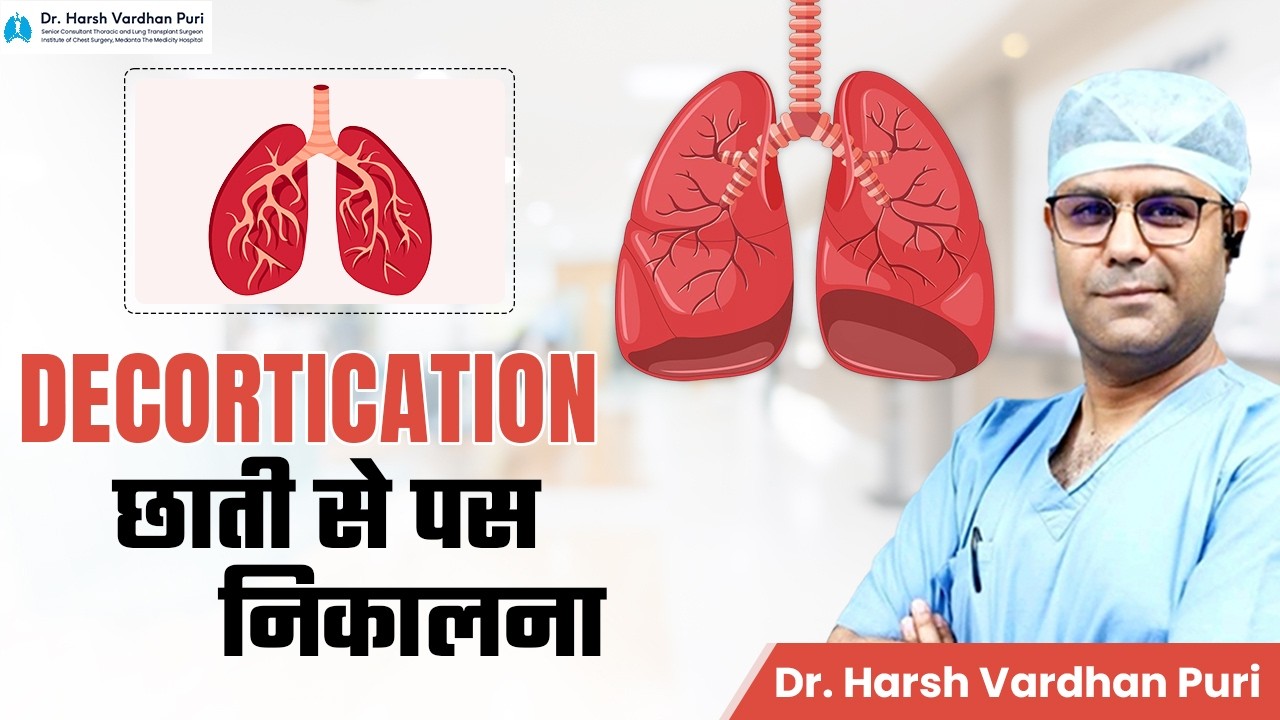 What is Decortication Surgery? Decortication कैसे किया जाता है Step by ...