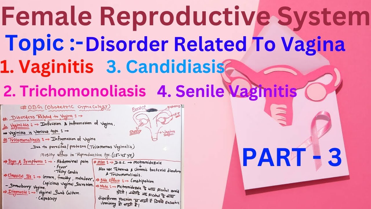 Disorder Related To Vagina || Vaginitis Disorder || Candidiasis ...