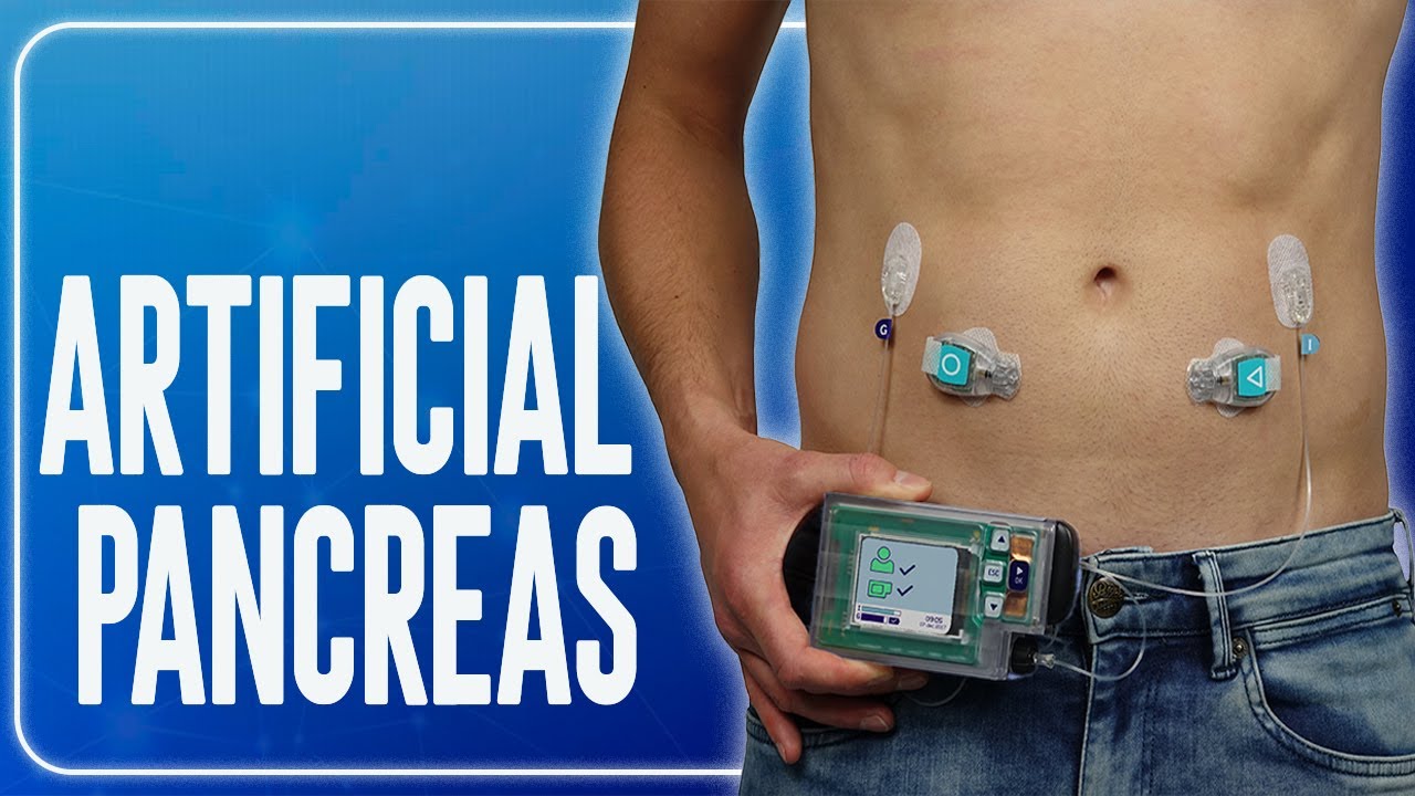 The Dual-Hormonal Pump Explained - Inreda's Artificial Pancreas - YouTube
