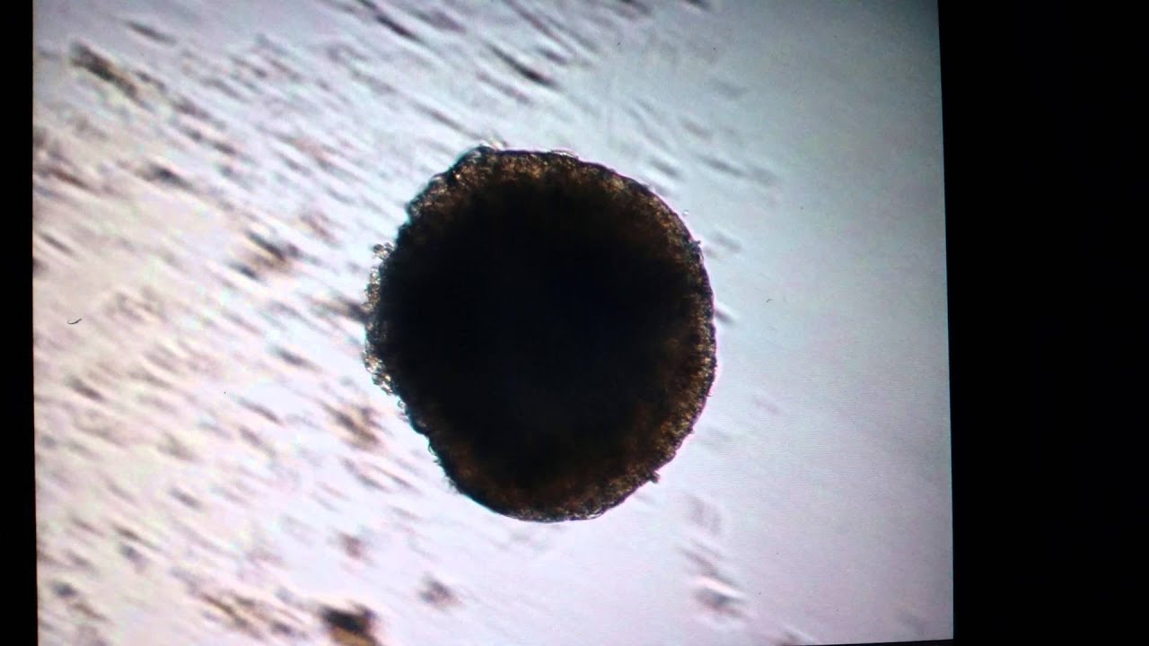 Beating 10 day old embryoid body from mES cells - YouTube