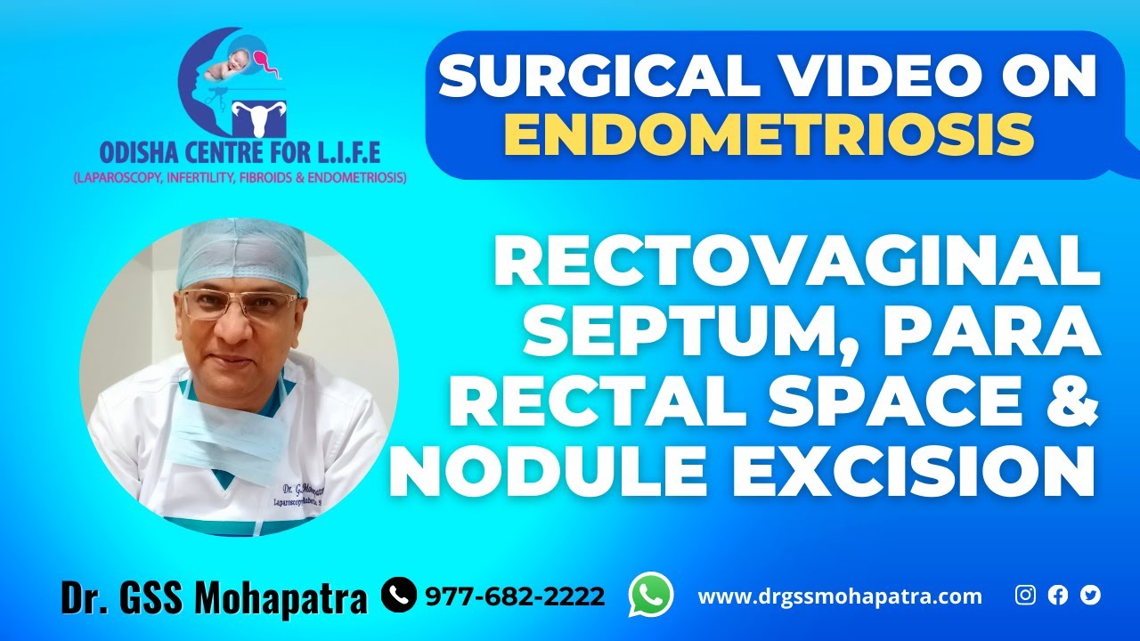 ENDOMETRIOSIS : RECTOVAGINAL SEPTUM, PARA RECTAL SPACE & NODULE EXCISION BY DR GSS MOHAPATRA ...