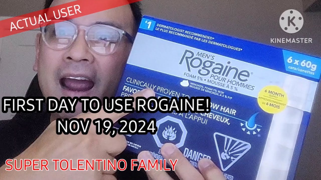 Rogaine for Men 👨‍🦳⚕️ - Actual User First Day November 19, 2024 - YouTube