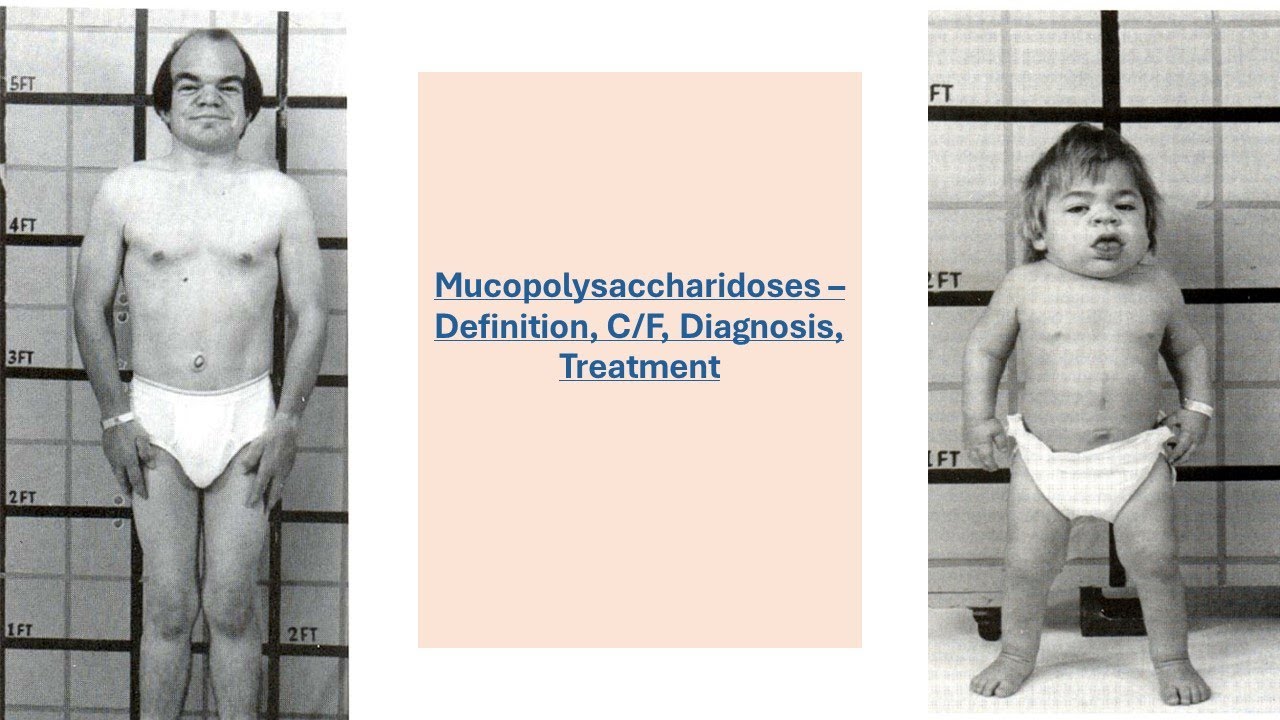 Mucopolysaccharidosis Biochemistry || Mucopolysaccharidosis - YouTube