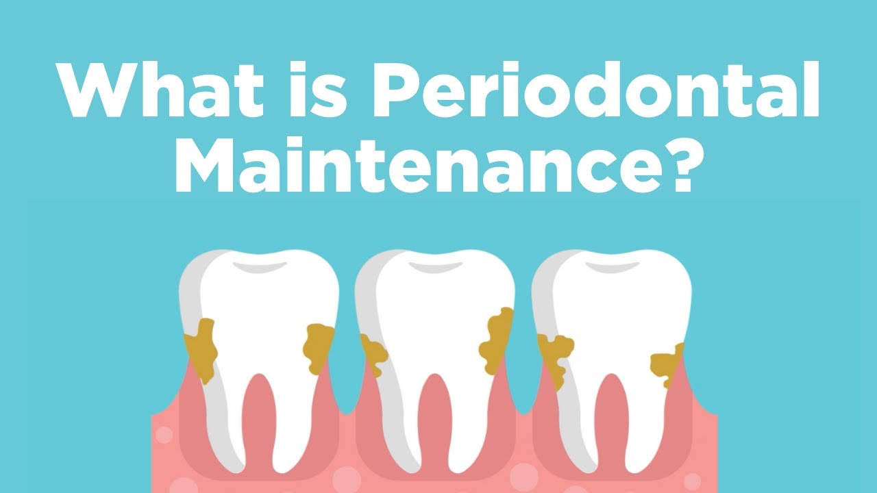Periodontal Maintenance - What is it? - YouTube