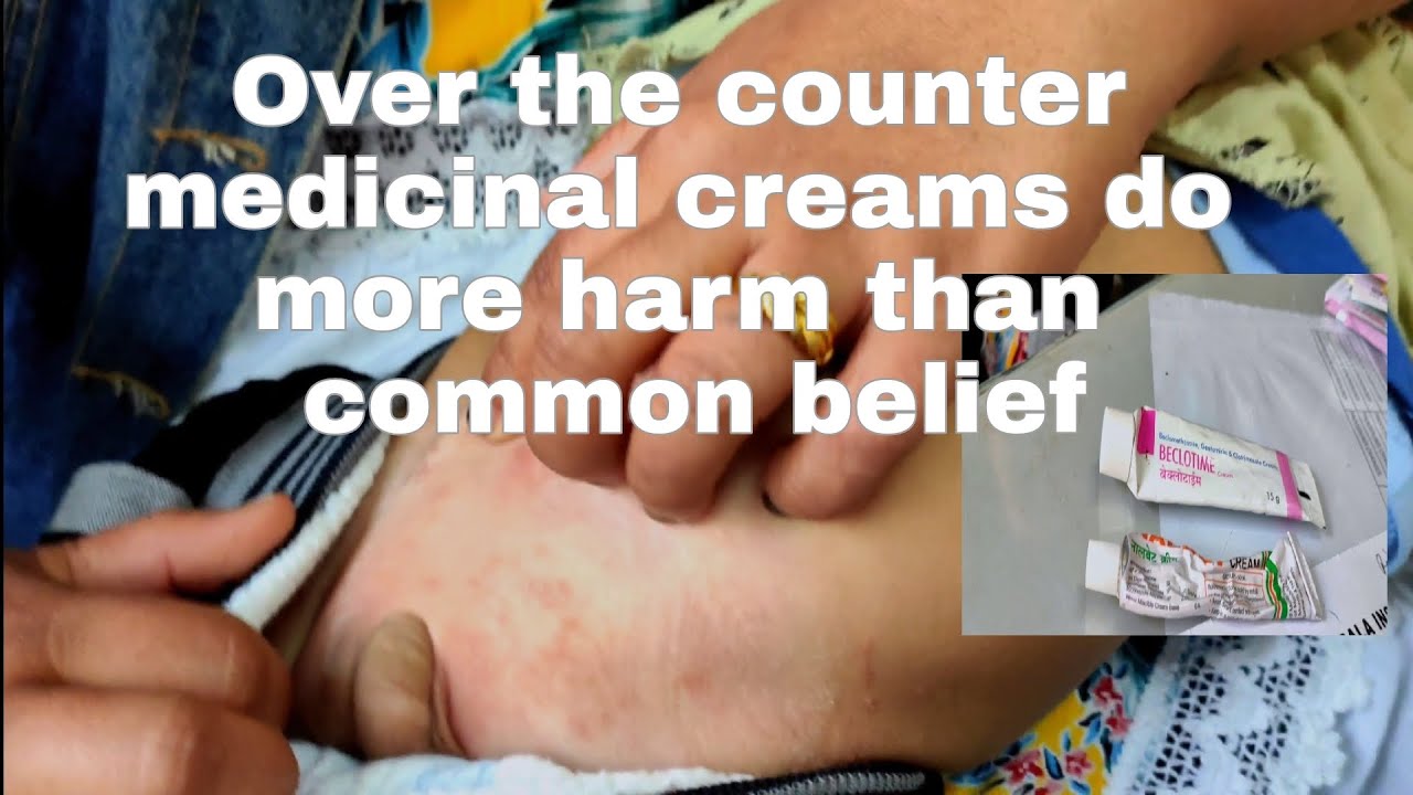 Over the counter medicinal creams do more harm than common belief || Dr ...