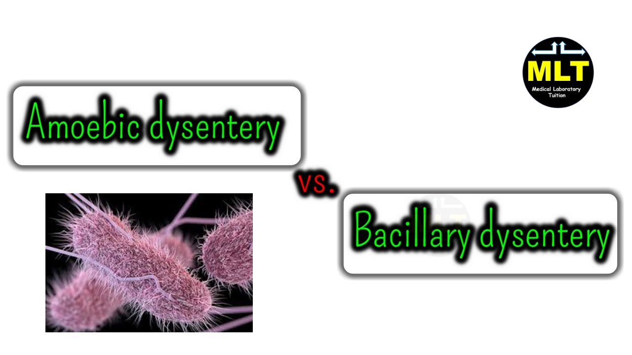amoebic dysentery vs bacillary dysentery in hindi - YouTube