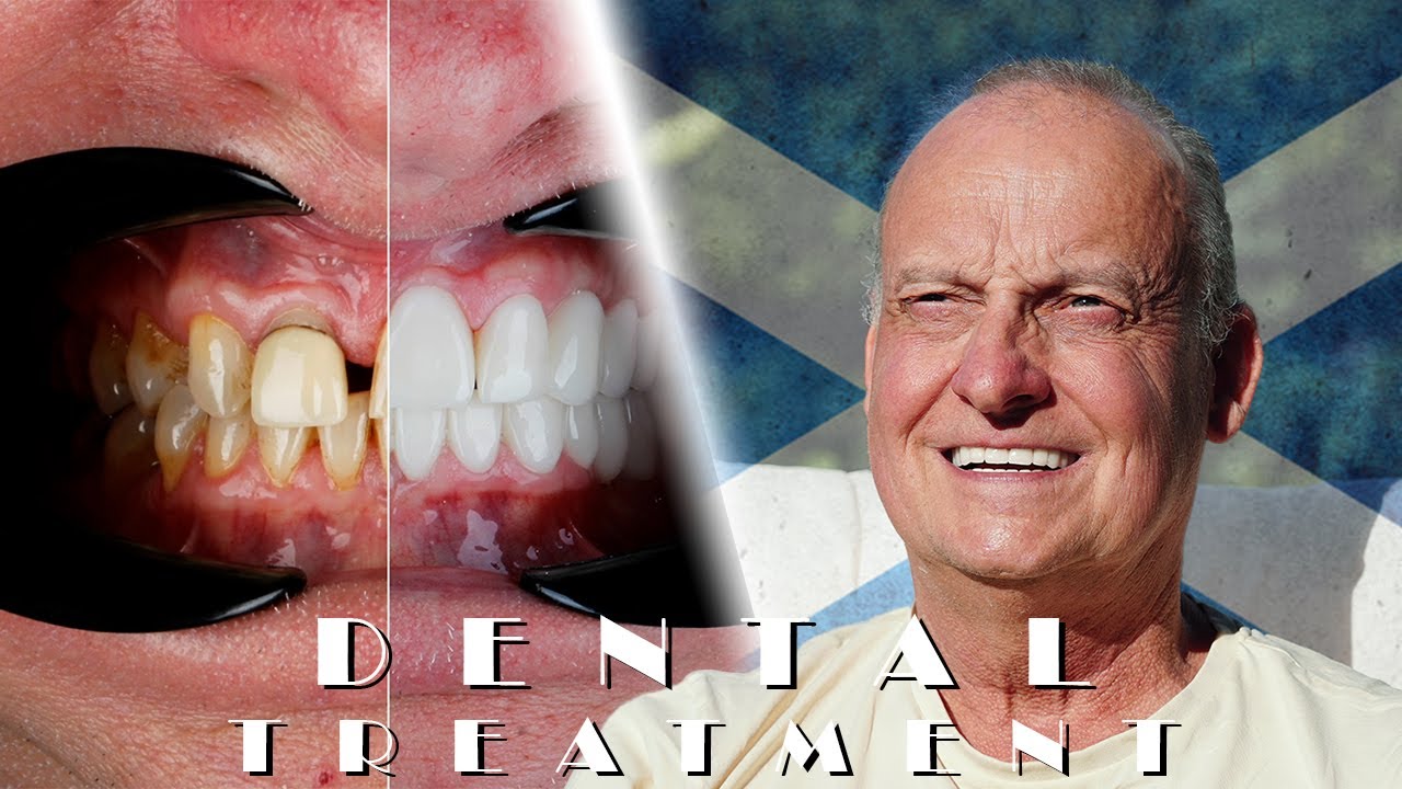 Brian From Scotland Got His Teeth Done at Dental Wise Turkey - YouTube