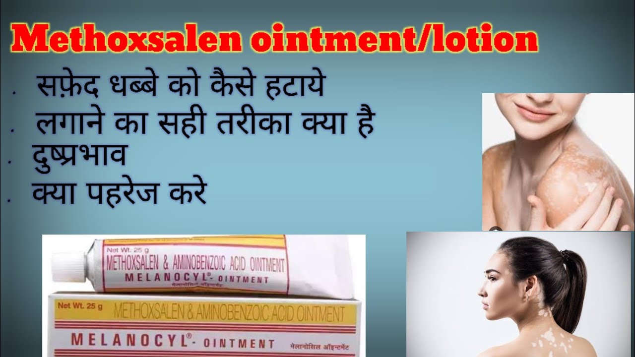 methoxsalen ointment/ methoxsalen lotion/ how to use methoxsalen 😨😨 ...