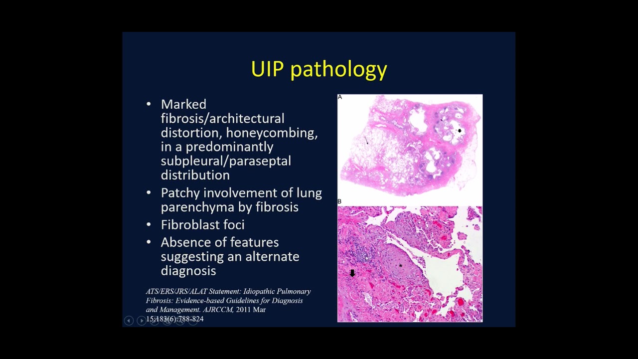 Thoracic Radiology part 3 - YouTube