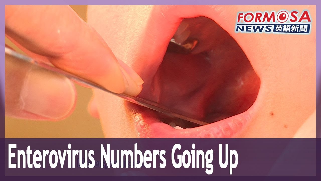 Over 17,000 medical visits with enterovirus symptoms mark 10-year high｜Taiwan News - YouTube