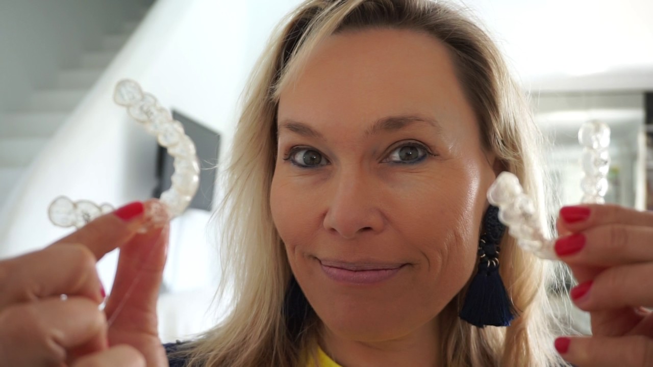 Mo's doorzichtige beugel van Invisalign - YouTube