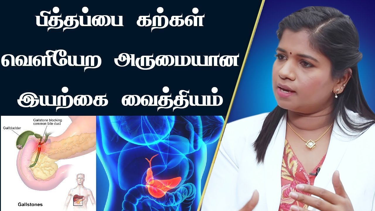 பித்தப்பை கற்கள் இருப்பதற்கான அறிகுறிகள் மற்றும் தீர்வு | Gallbladder ...