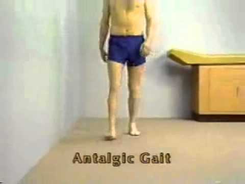 Orthopedic Physical Examination Gait - YouTube