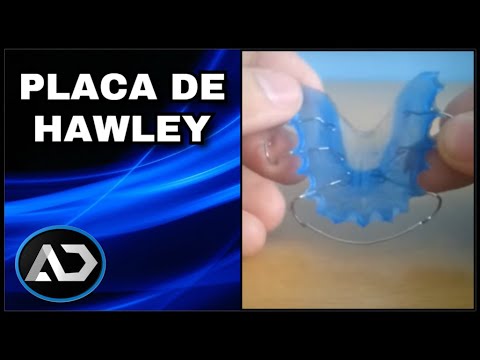 ¿Que Es Un Retenedor Hawley? - YouTube