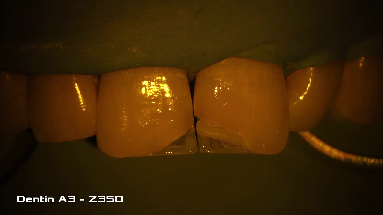 Class IV tutorial - YouTube