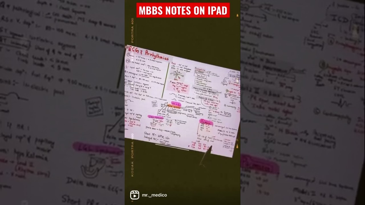 MBBS STUDENT - Notes on IPad Air 4 #shorts #ytshorts #mbbs #medicos ...