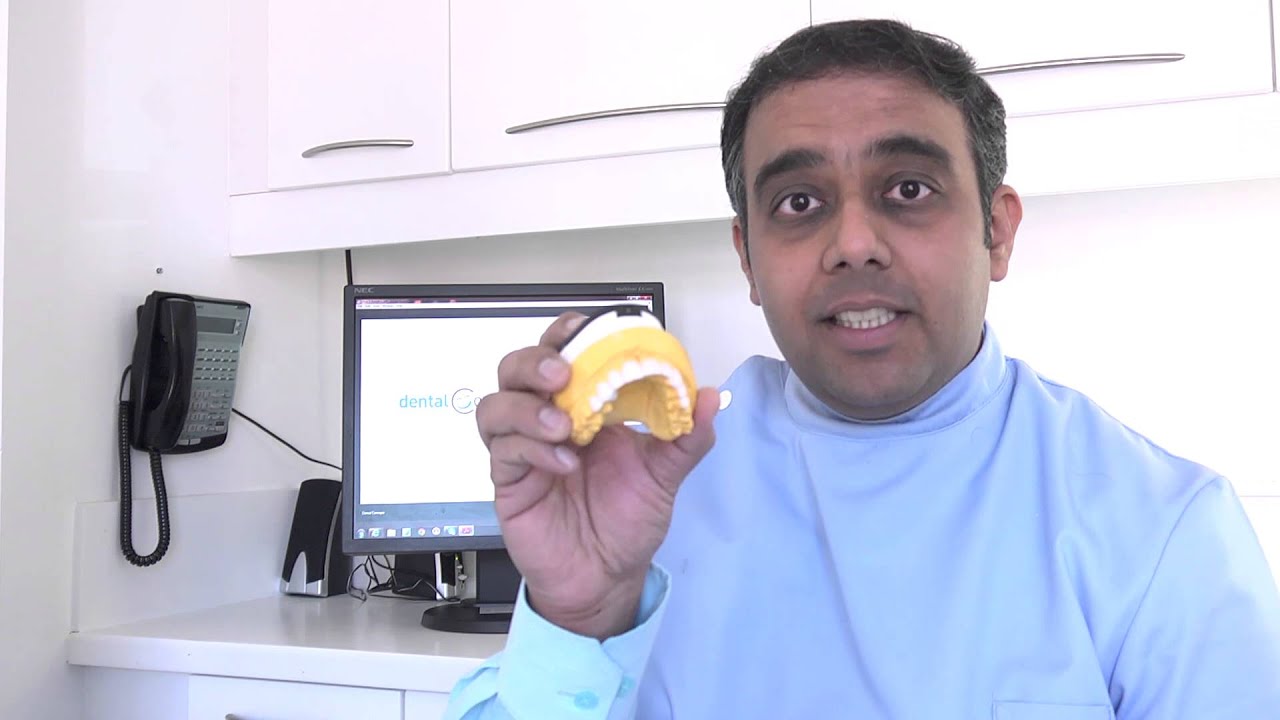 Dental Concepts... "The Smile Makeover Test Drive" - YouTube