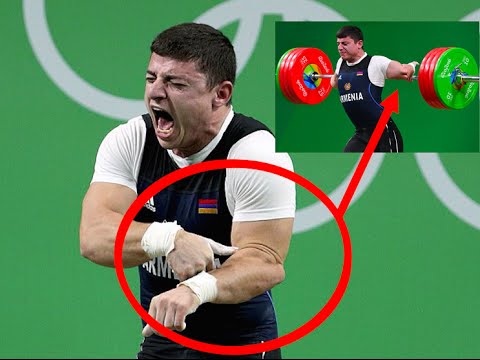 The Most Disturbing Injuries At The Olympic Games - YouTube