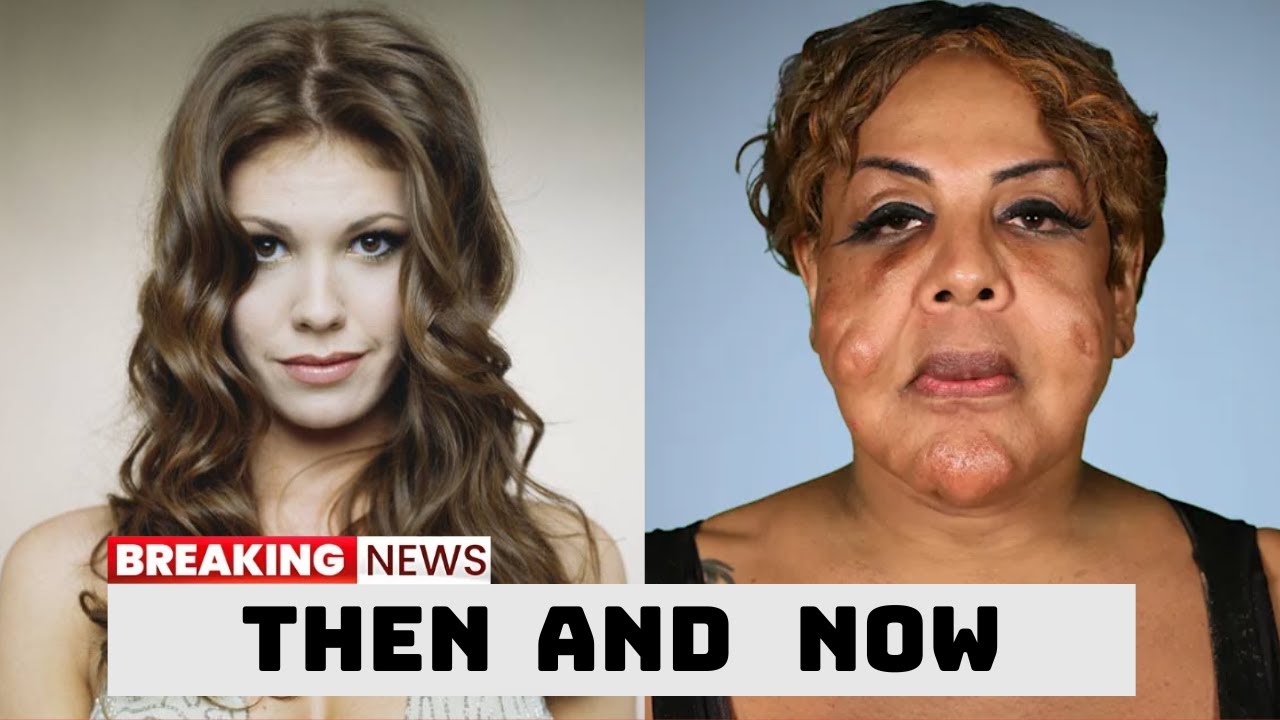 20 Celebrity Plastic Surgery Disasters That Left Them Permanently ...