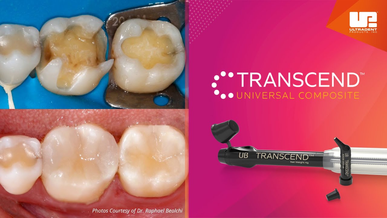 Composite Universal Transcend™ - YouTube