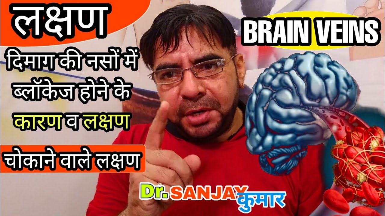 Dimag Ki Naso Ki Blockage,Kamzori Aur Sujan Ke Lakshan | Brain Vein ...